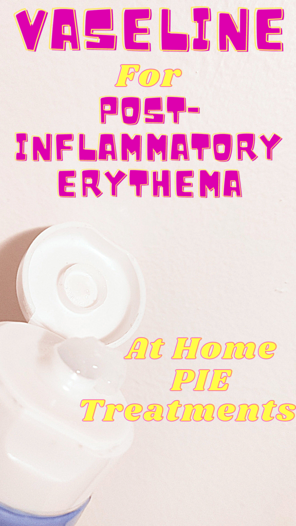 Vaseline For Post-Inflammatory Erythema? (At Home PIE Treatments)